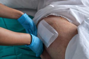 Tips for Wound Care Documentation | Relias